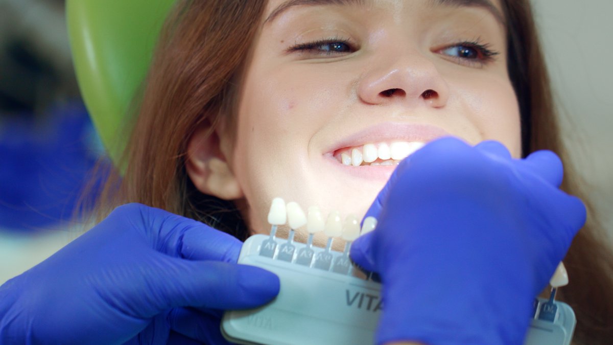 Bleaching: Wie geht das?